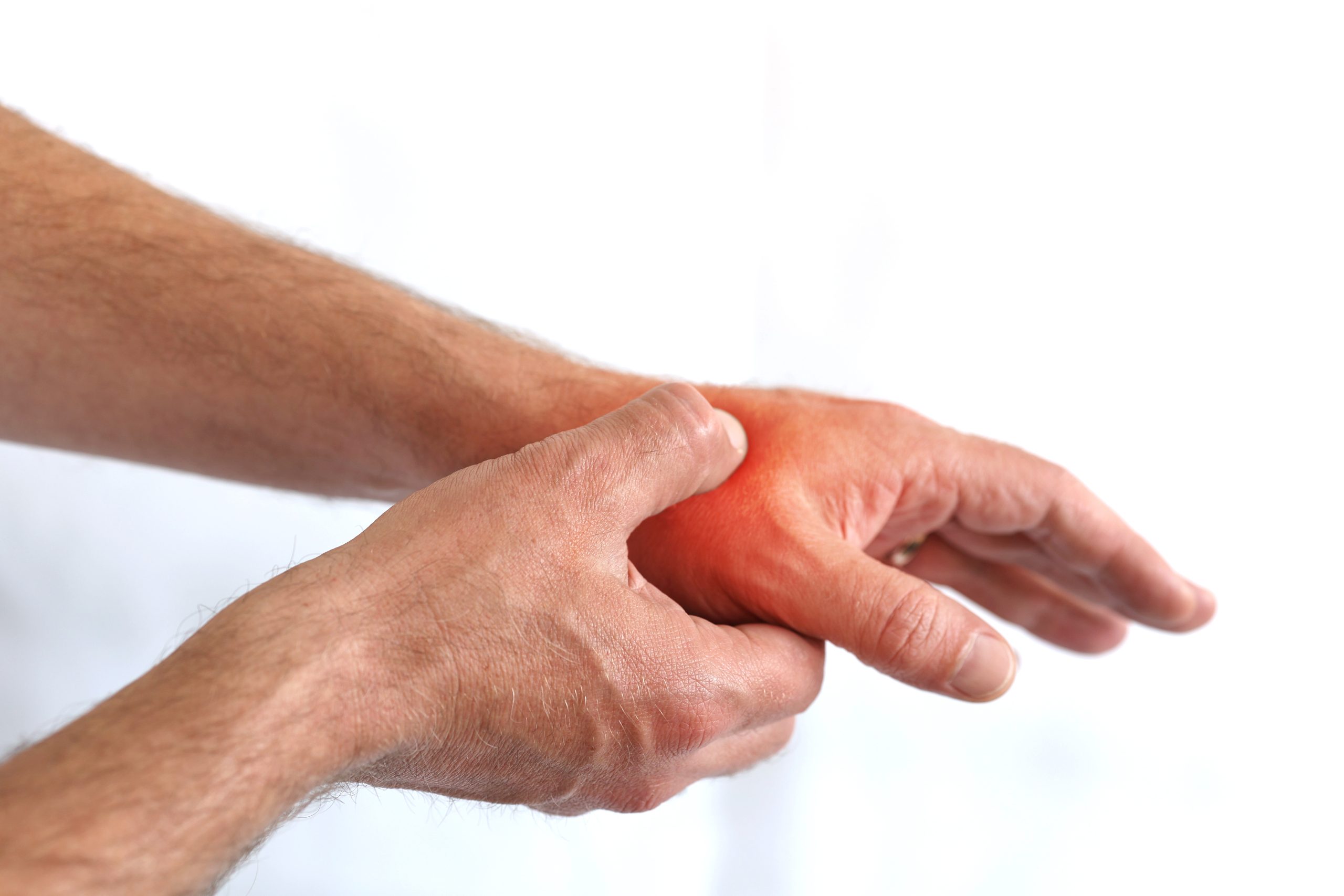 Rhizarthrosis | Hand Surgeon Vienna | Hand Surgery Vienna